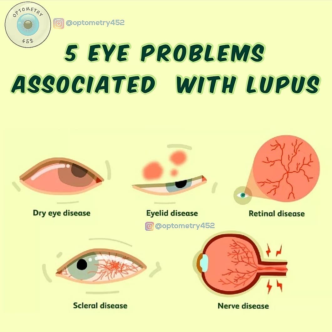 Lupus Pain Memes Chronic Illness Humor | #chronicillness #chronicpain