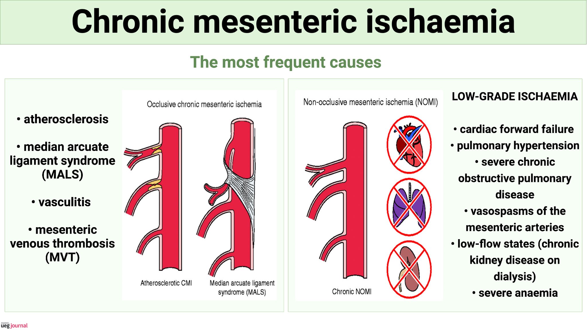 Mesenteric Artery Ischemia