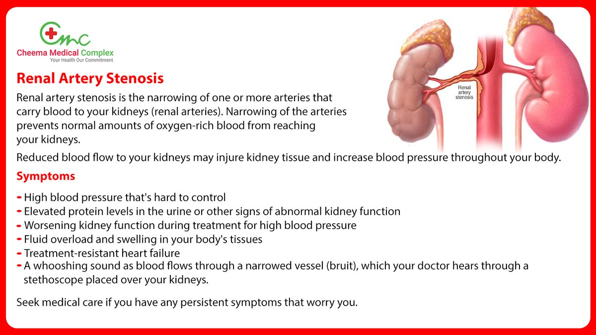 Renal Artery Stenosis