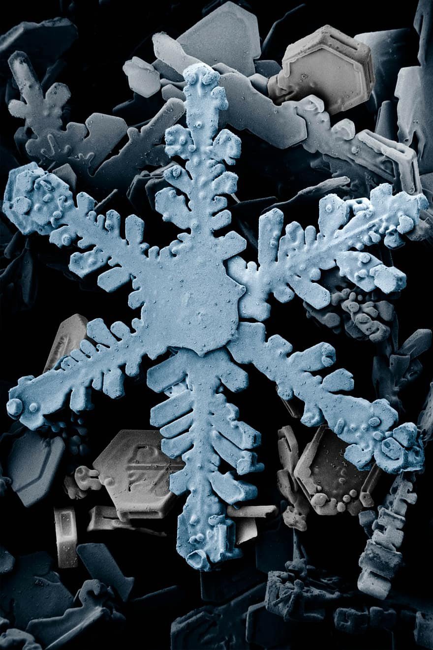Electron Microscope Ice