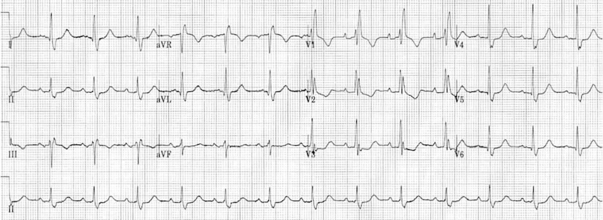 Time for a #tweetorial! In my medical training, I have seen several ...