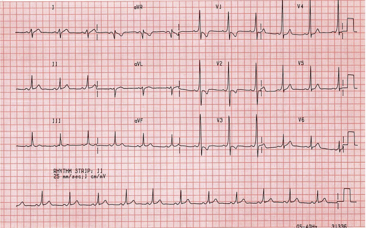 Time for a #tweetorial! In my medical training, I have seen several ...