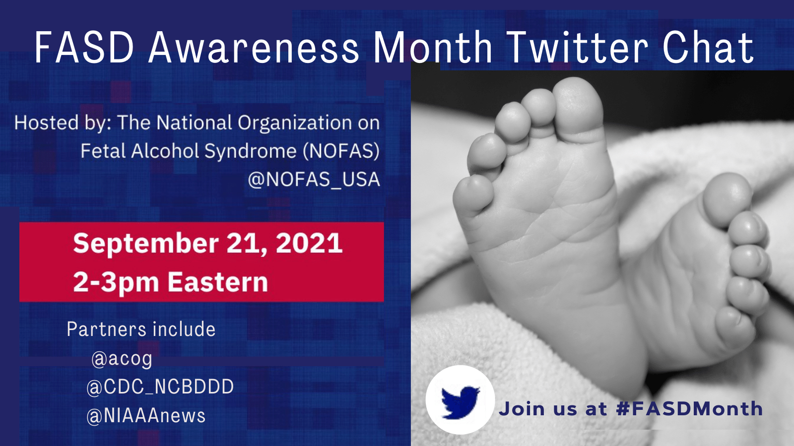 Fetal Alcohol Syndrome Feet