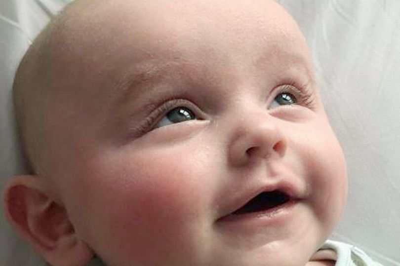 Krabbe Disease Krabbe Disease Rare Condition Left Baby Months Live Daily Mirror Scoopnest krabbe-disease-krabbe-disease-rare-condition-left-baby-months-live-daily-mirror-scoopnest