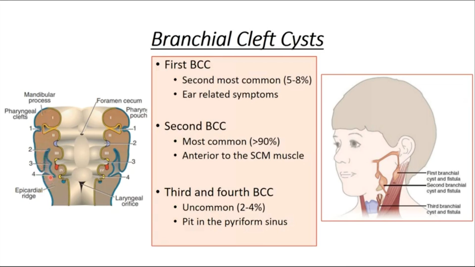 Branchial Cleft Cyst