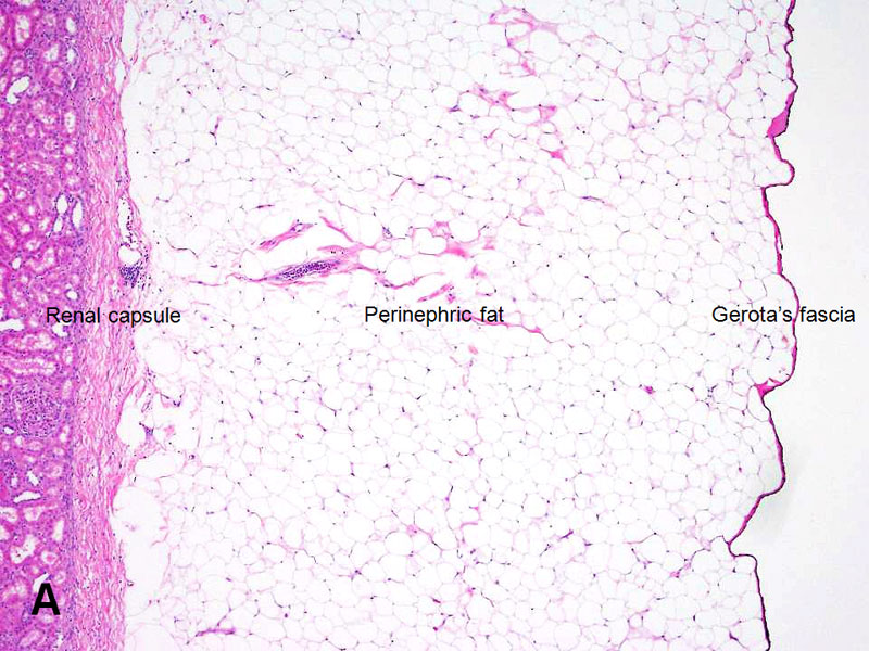 Gerotas Fascia