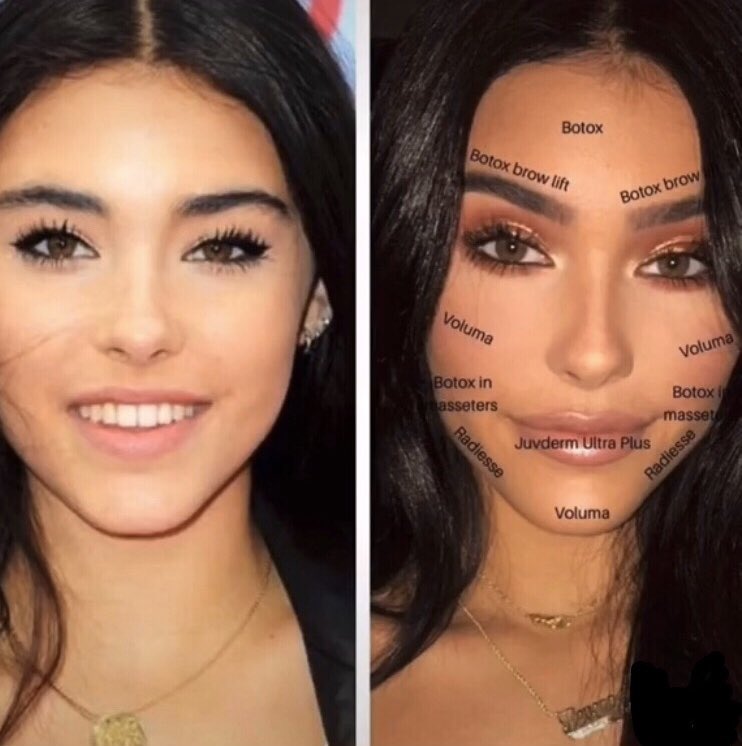 Madison Beer Before And After Madison Beer Before And After