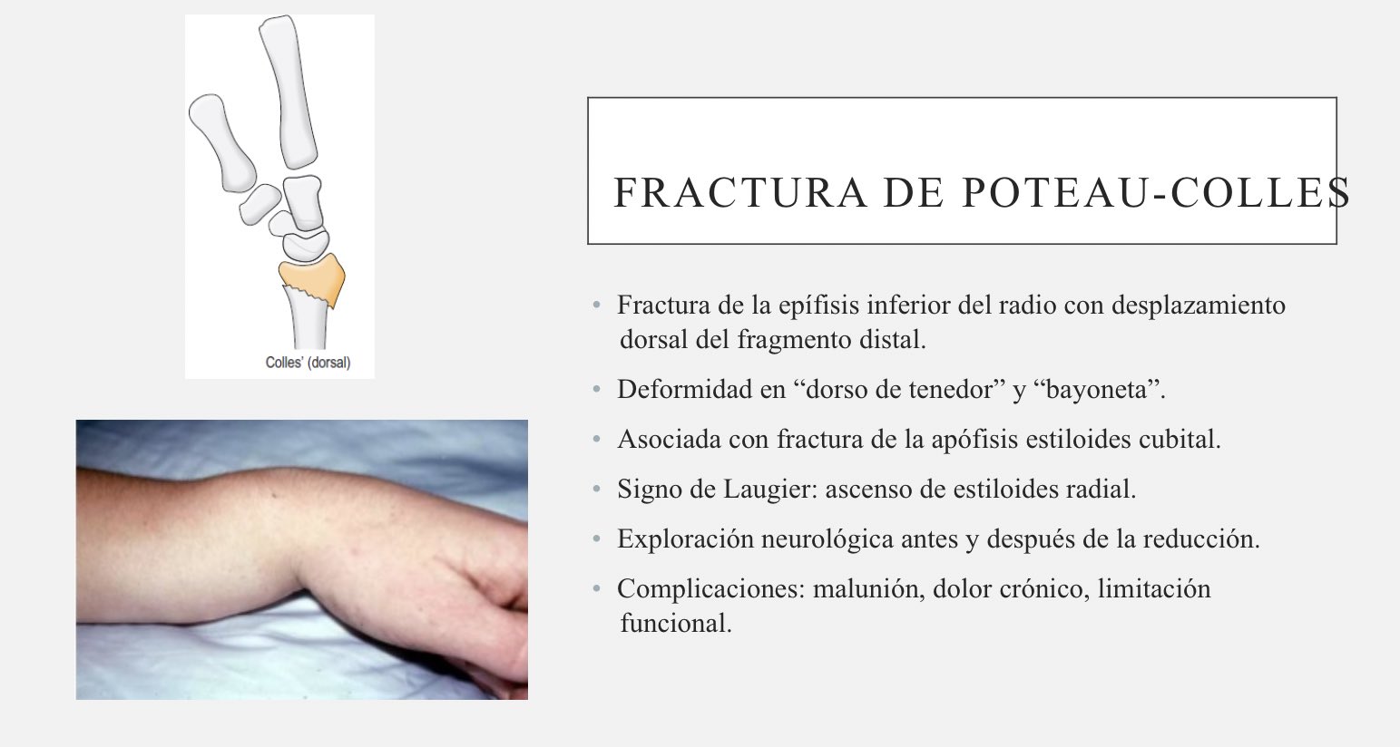 Campeonato Traducción Polvoriento fractura de muñeca en ancianos ...