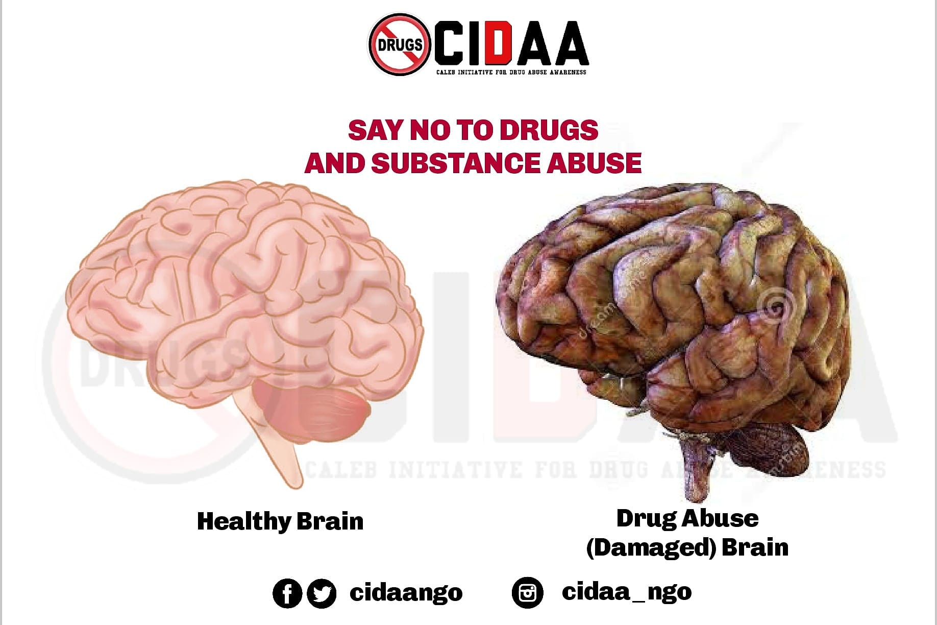 Damaged Brain From Drugs