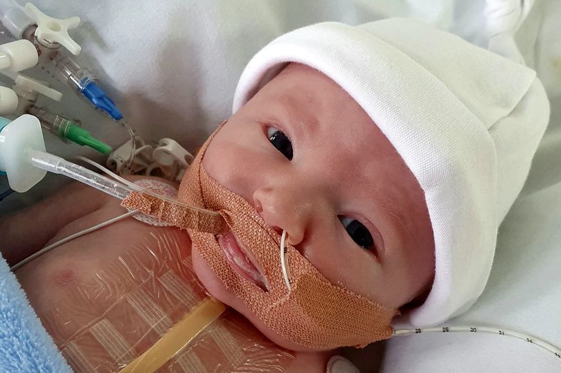 'Miracle' baby makes amazing recovery from open heart surgery at one ...