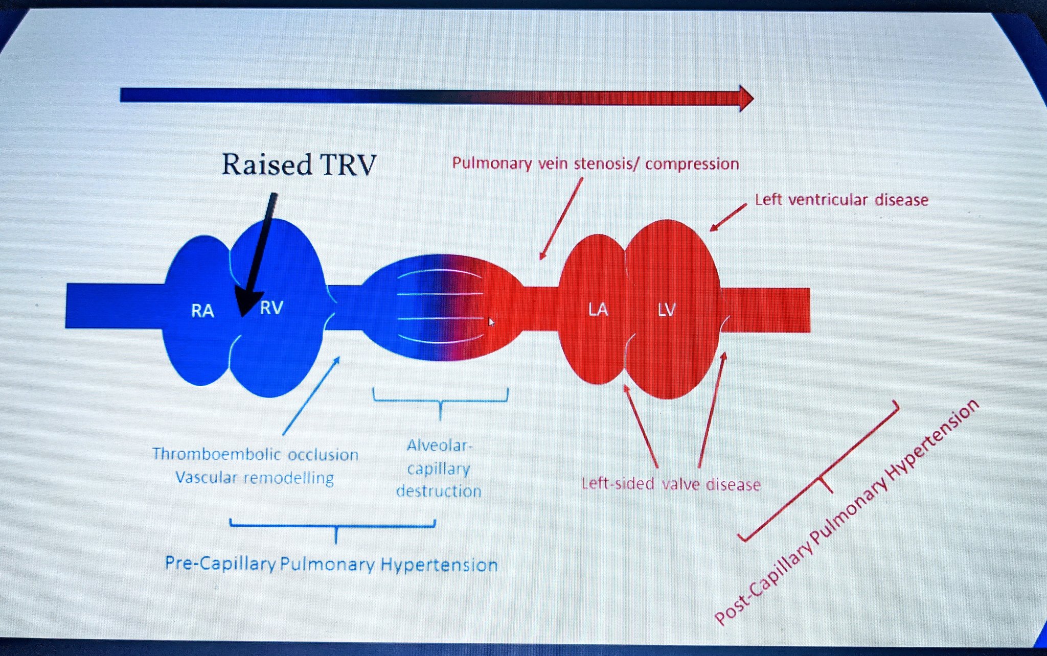 Aaysha Cader On X: Pulmonary Hypertension- Pathophysiology, 42% OFF