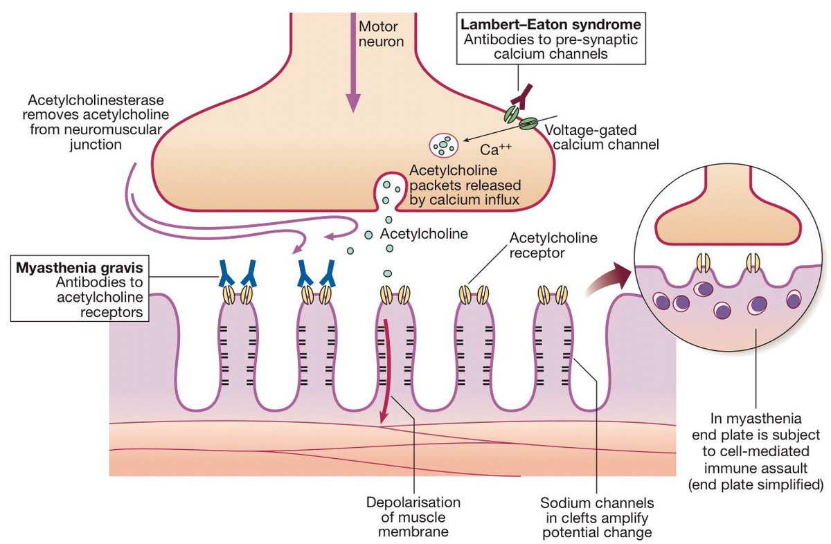 Myasthenia Gravis Neuromuscular Junction
