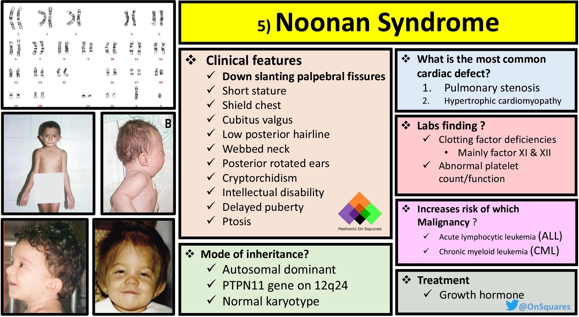Noonan Syndrome Neonate Spectrum Of Mutations And Genotype–phenotype