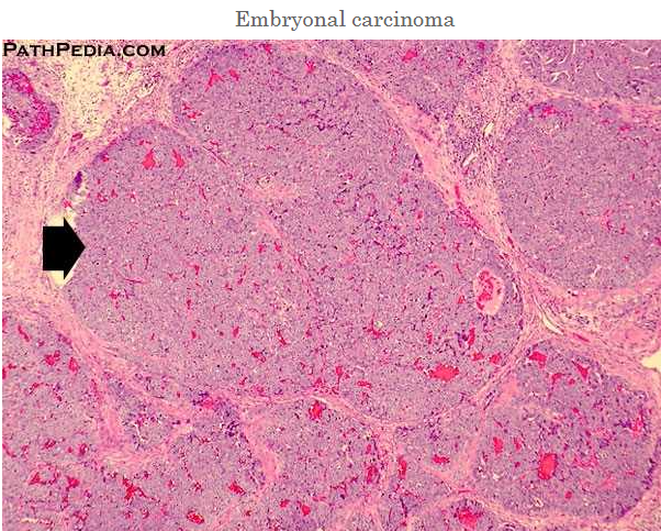Embryonal Carcinoma Cells