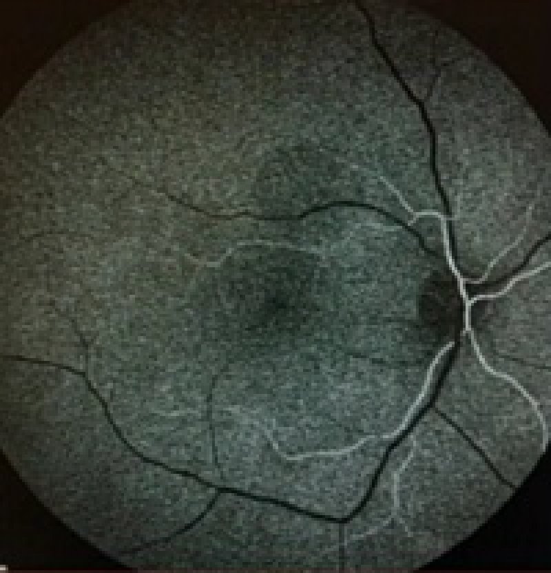 Optometry Scope (@OptometryScope) | Twitter