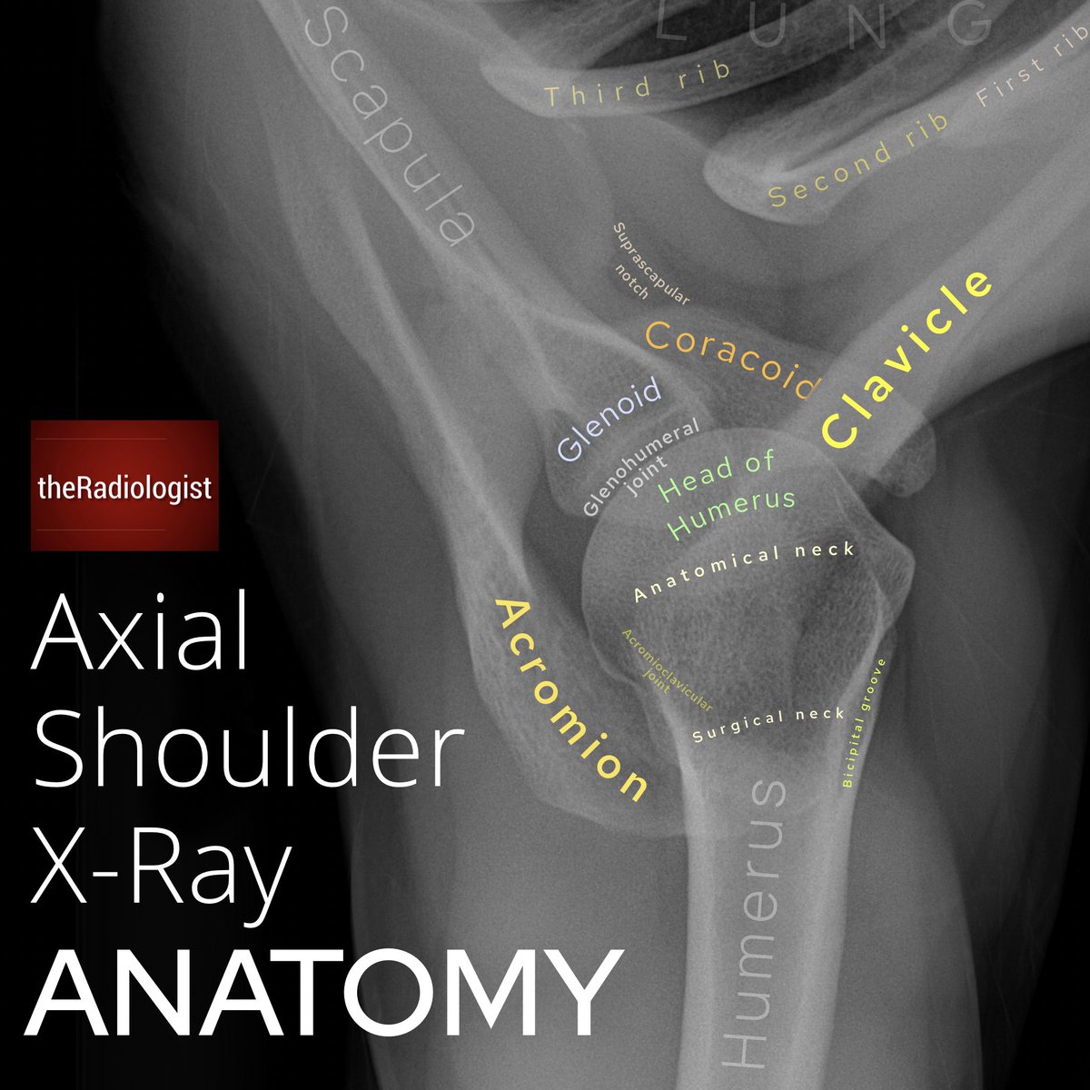 Humerus X Ray Labeled