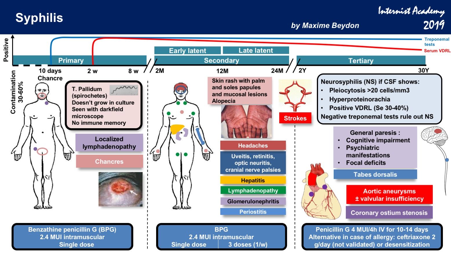 Syphilis Stages Diagram