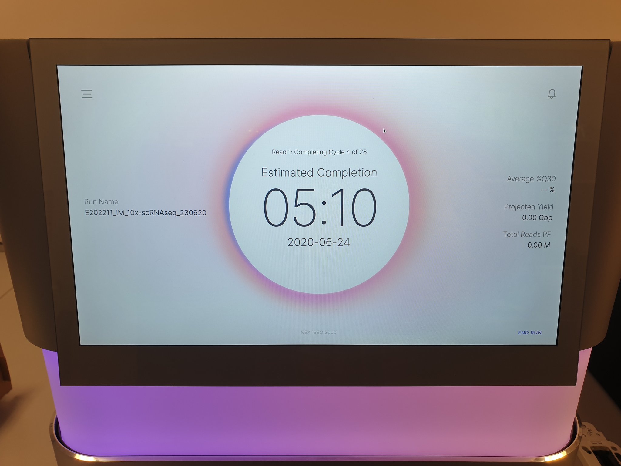 Waiting Impatiently At Computer