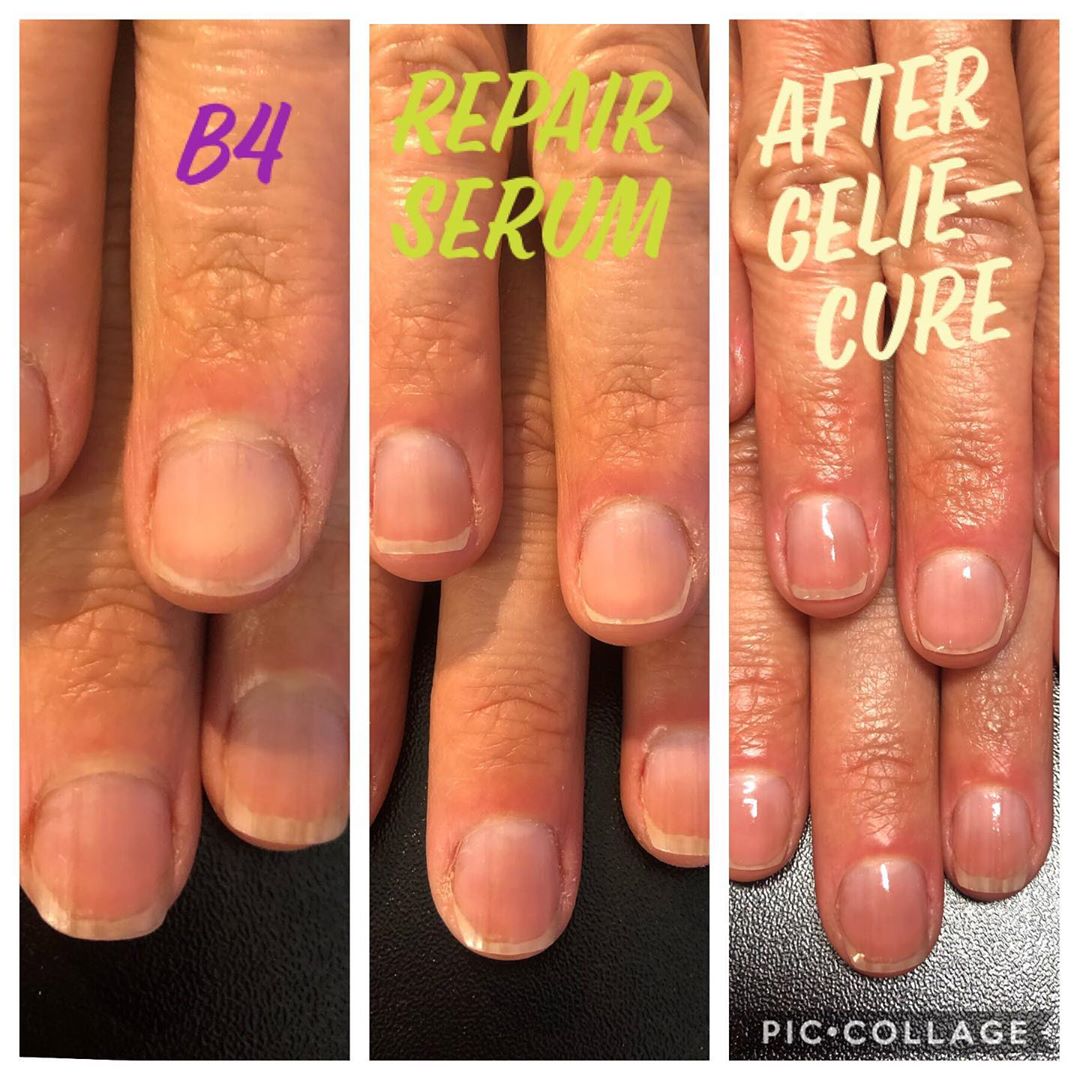 Have you tried our Treatment system, Gelie-Cure yet? If so, what is ...