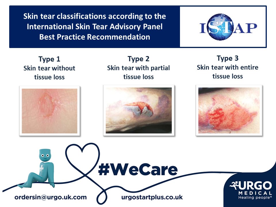 Star Skin Tear Classification Skin Tears Update