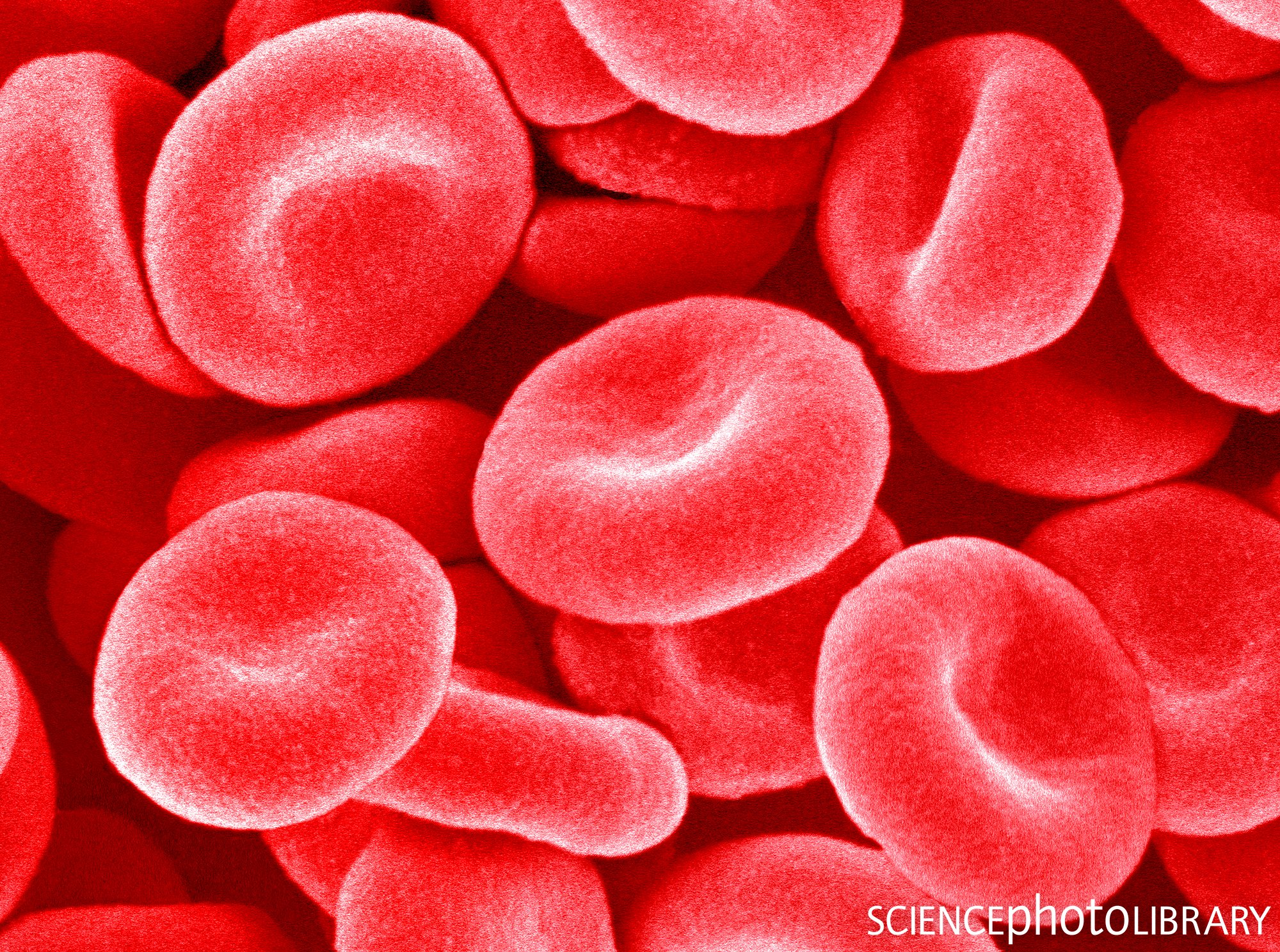 Biconcave Disc RED BLOOD CELLS ARE BICONCAVE