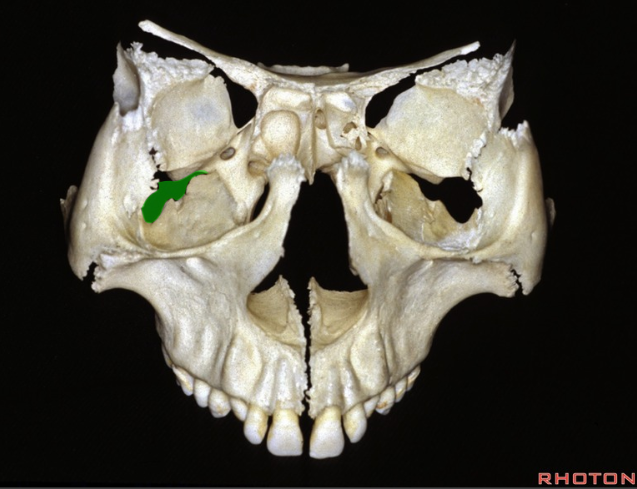 Inferior Orbital Fissure Sphenoid