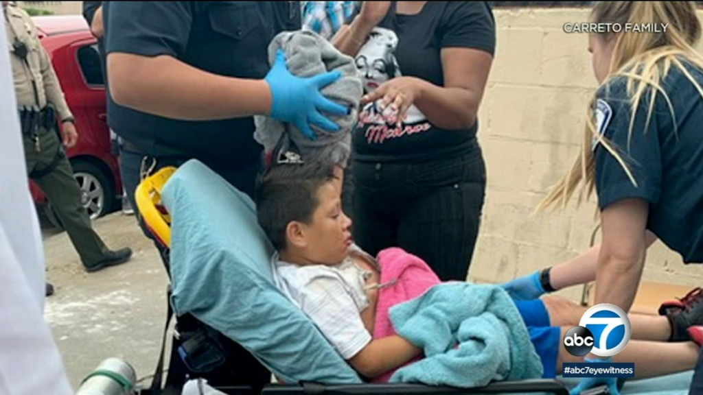 Boy who lost his hand to fireworks: 'I want to tie my shoes' | ABC13 ...