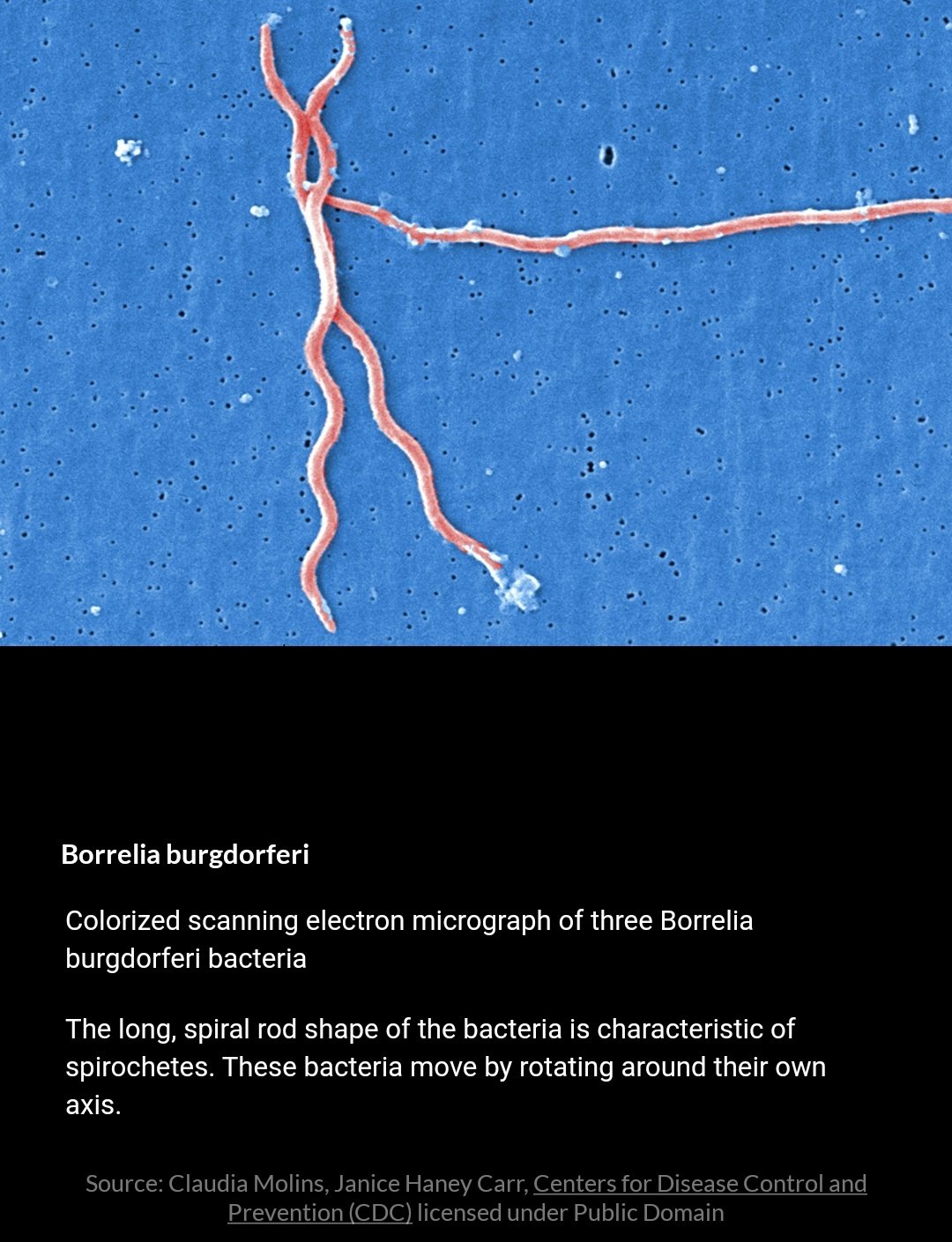Borrelia Burgdorferi Bacteria Microscope