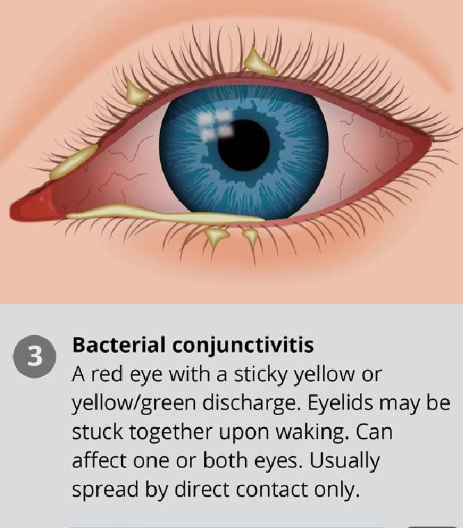 Optometry Scope (@OptometryScope) | Twitter