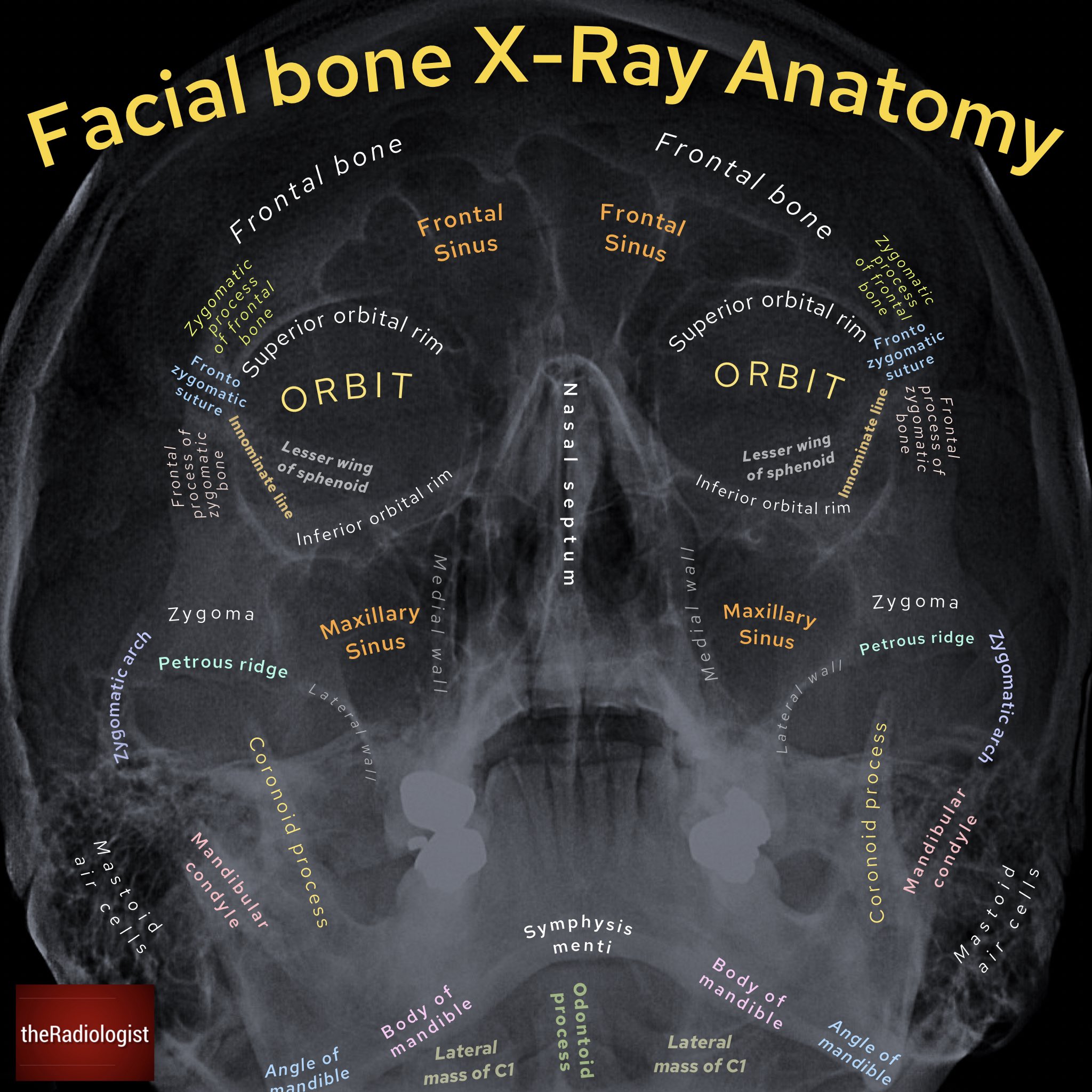 Face Bone Anatomy Ct
