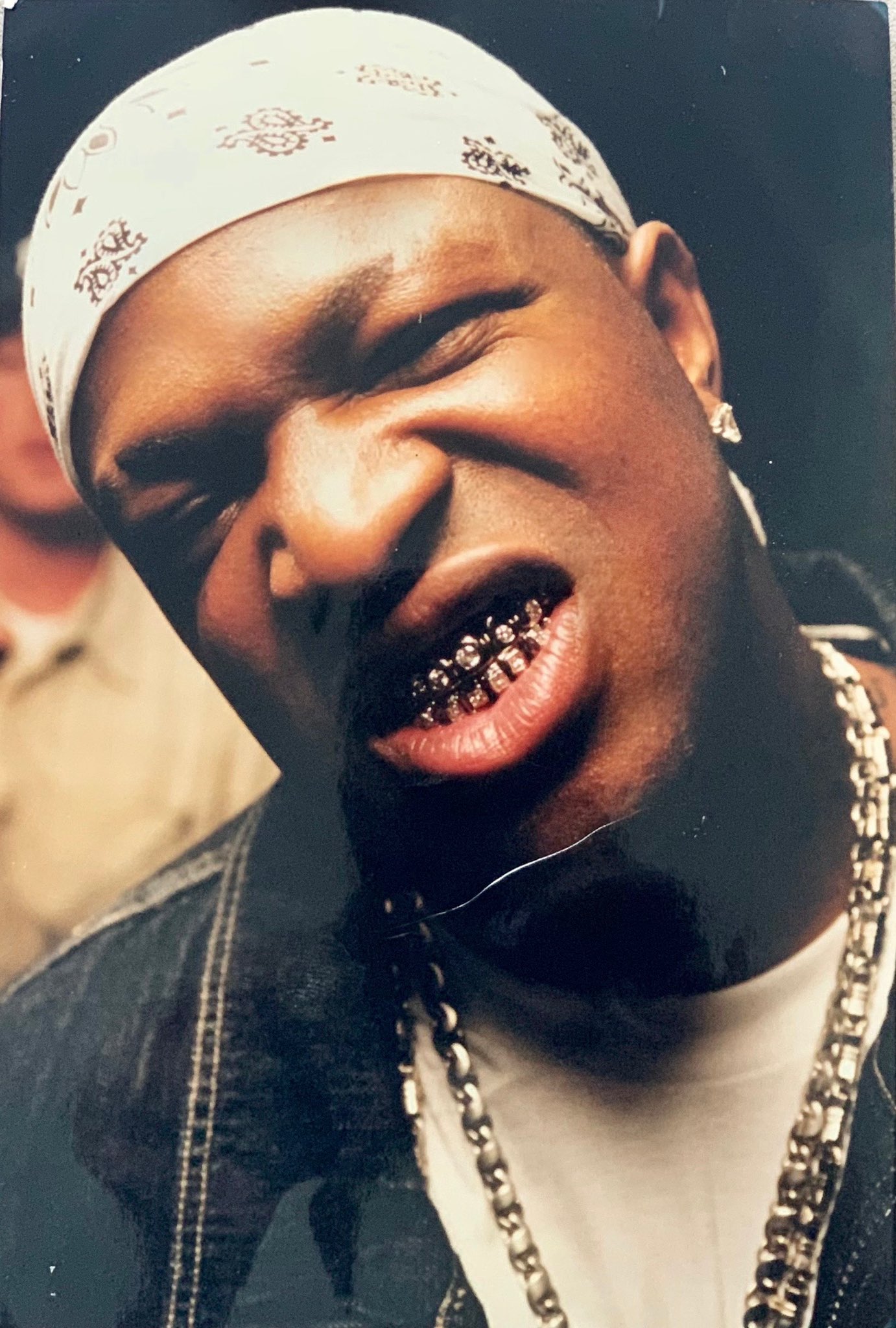Birdman Rapper Teeth