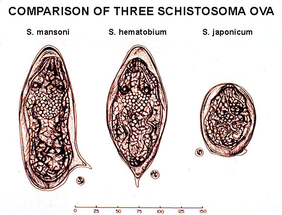 Schistosoma Japonicum Ova