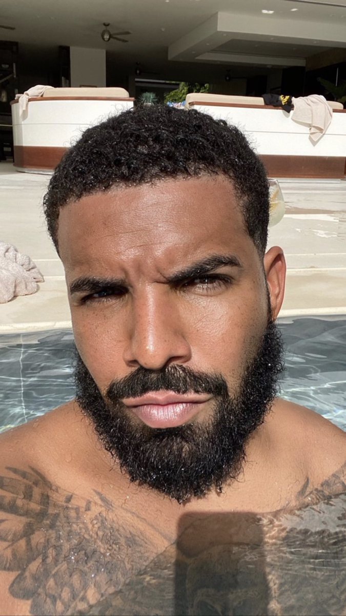 Drake Nose Job