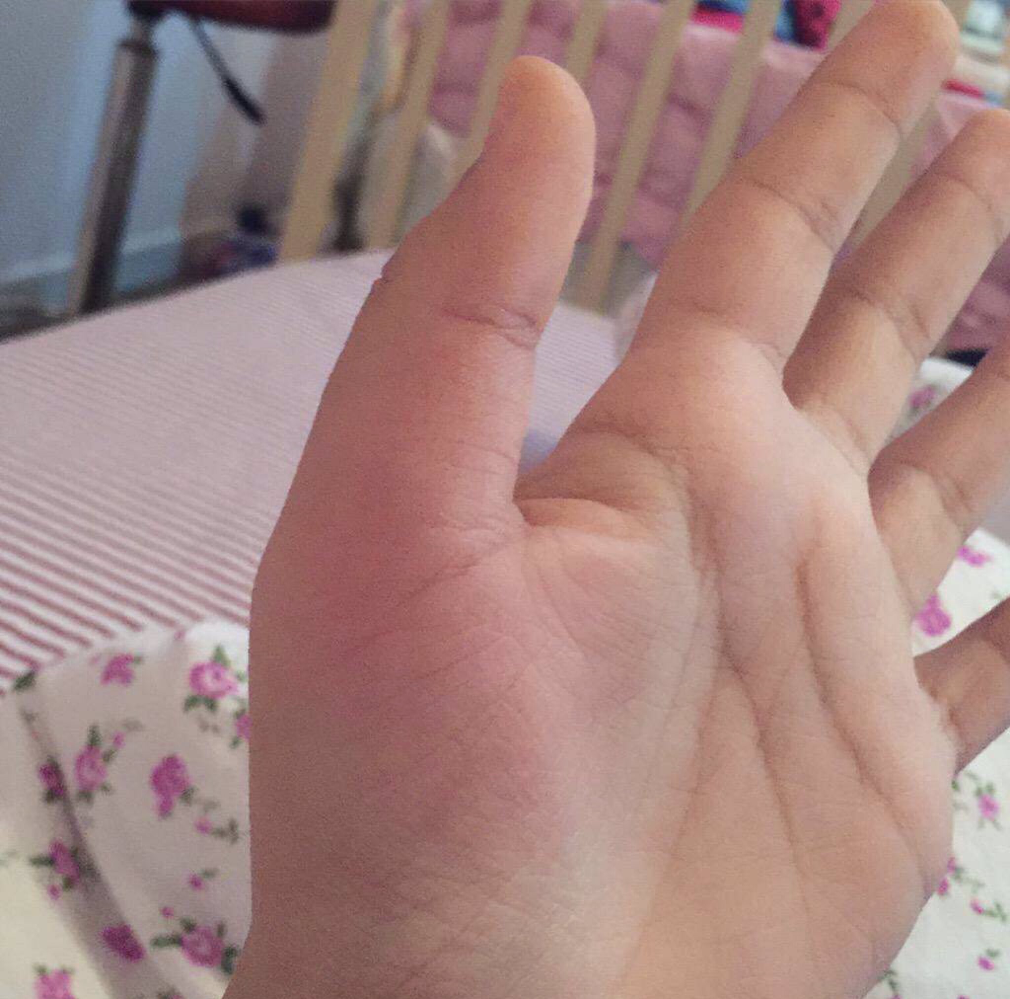 Swollen Thumb Joke Ups