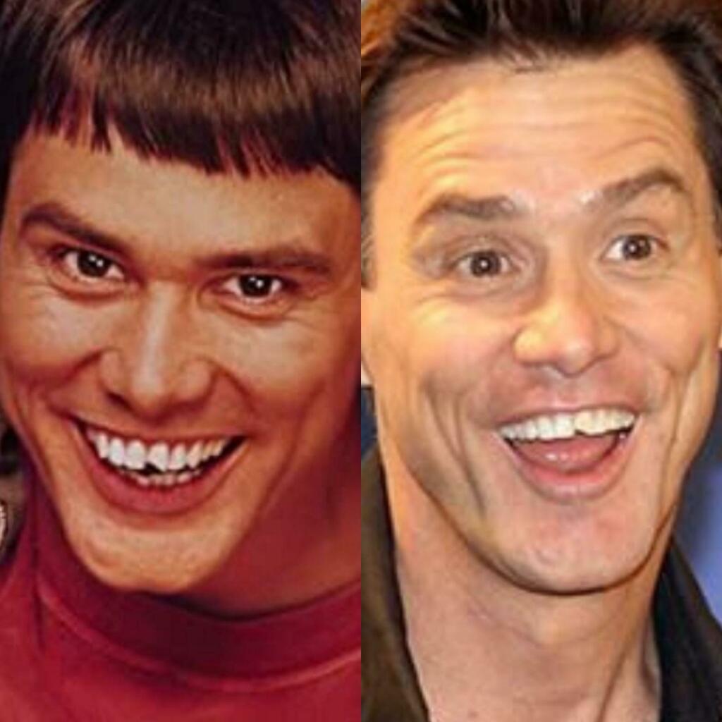 Jim Carrey Chipped Tooth