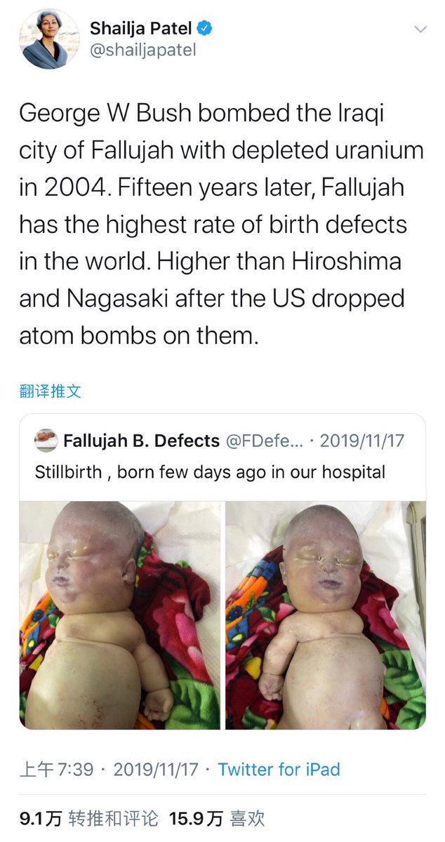 Birth Defects From Radiation