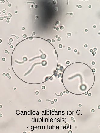 Candida Germ Tube
