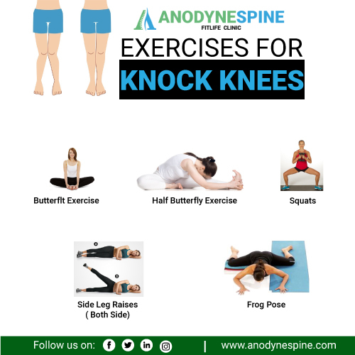 Knock Knees Correction Exercises