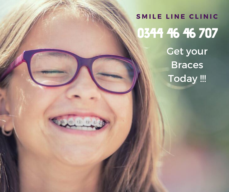 Braces Quotes And Sayings