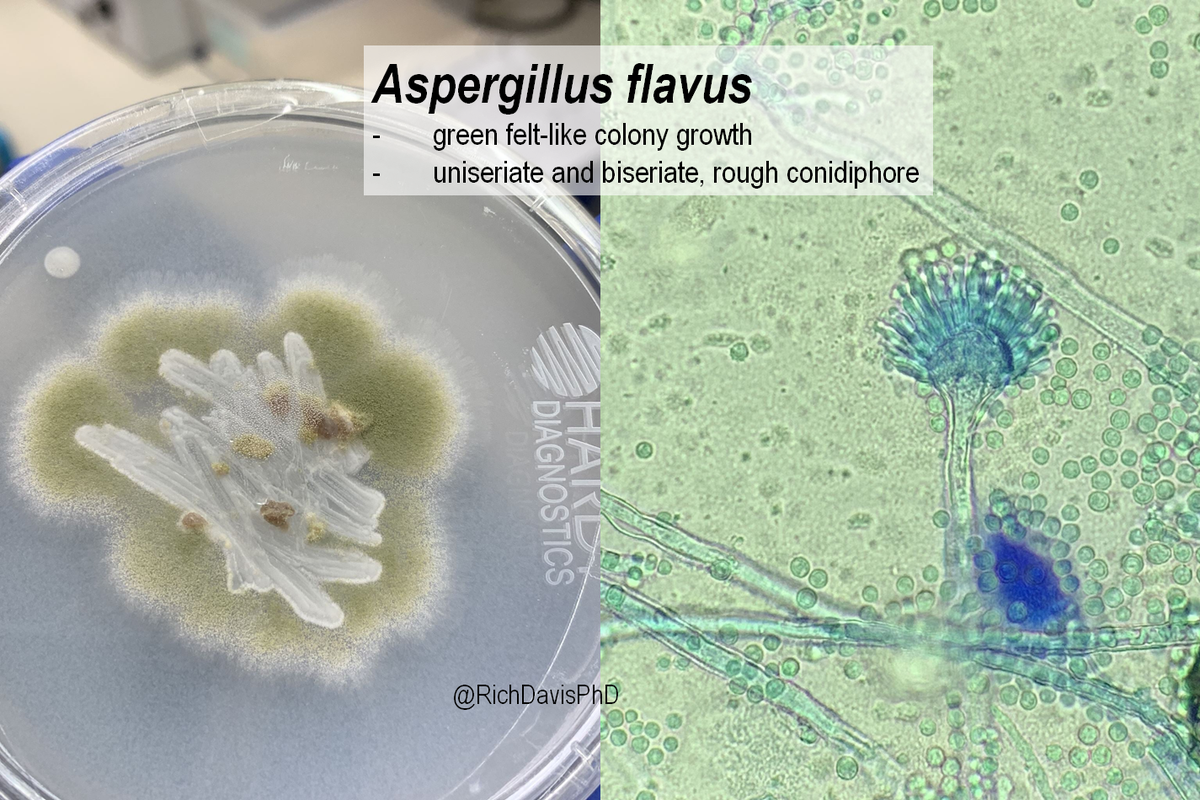 Aspergillus Flavus Culture