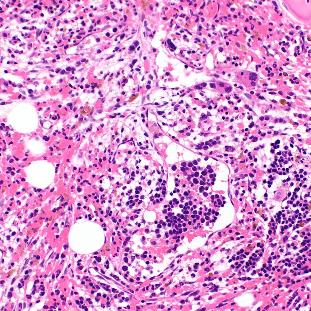 A little exposition about reticulin & the #specialstain of the same ...