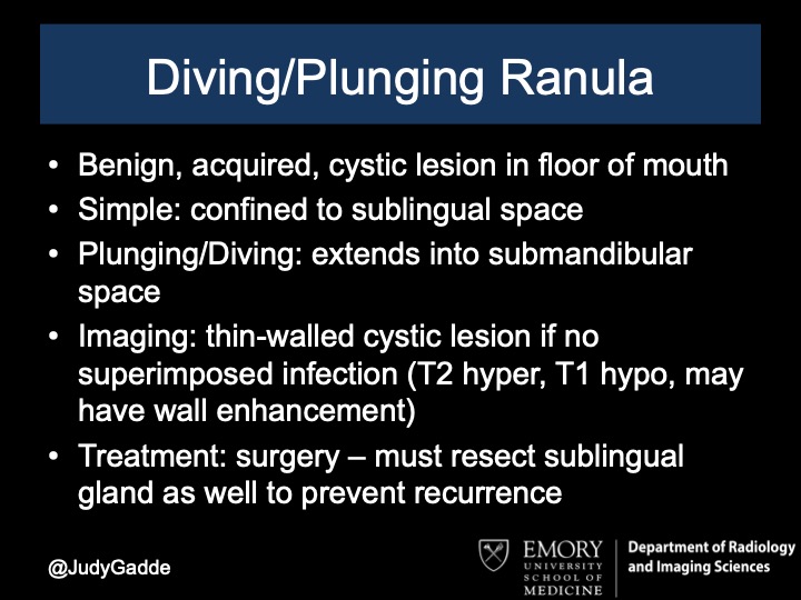 Plunging Ranula