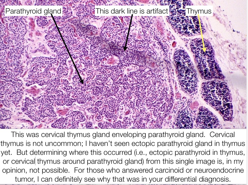 Parathyroid Histology Labeled