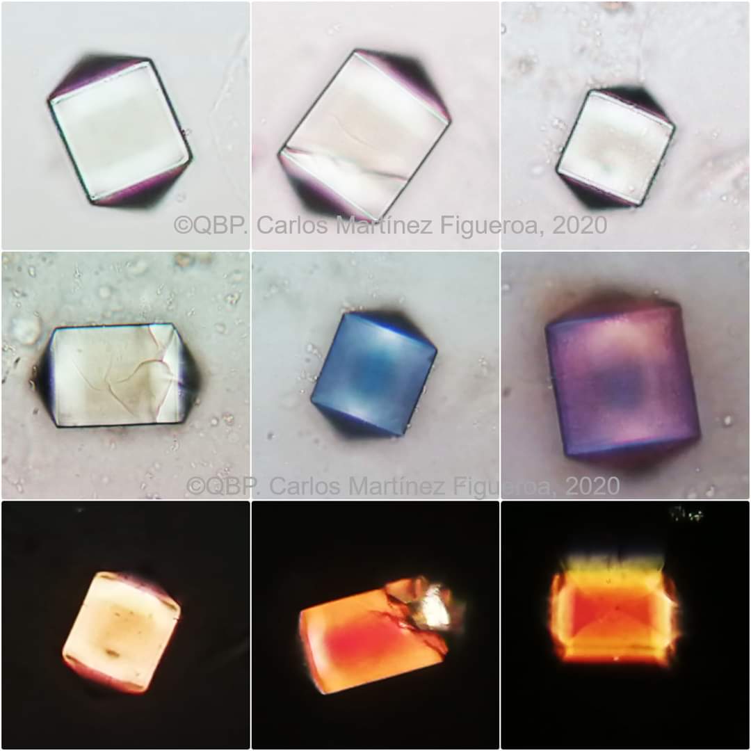 Cristales De Oxalato De Calcio