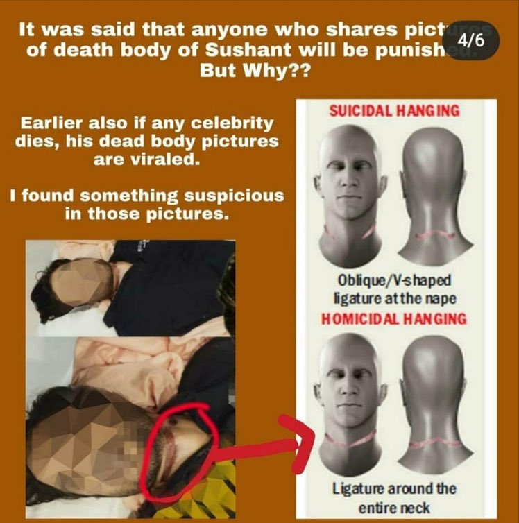 Ligature Hanging JKMS :: Journal Of Korean Medical Science