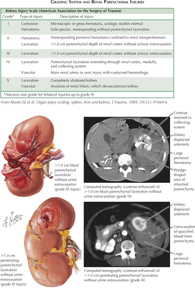 Extravasation Of Urine