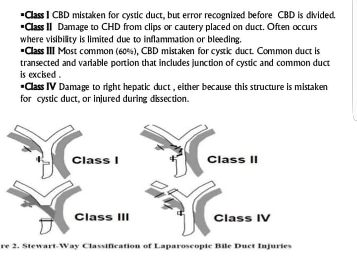 Stewart Way Classification