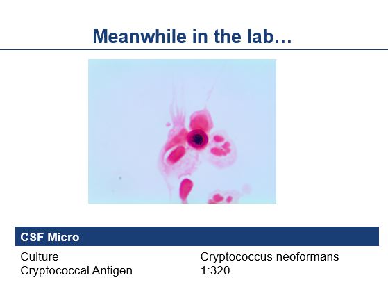 Cryptococcus Neoformans Culture