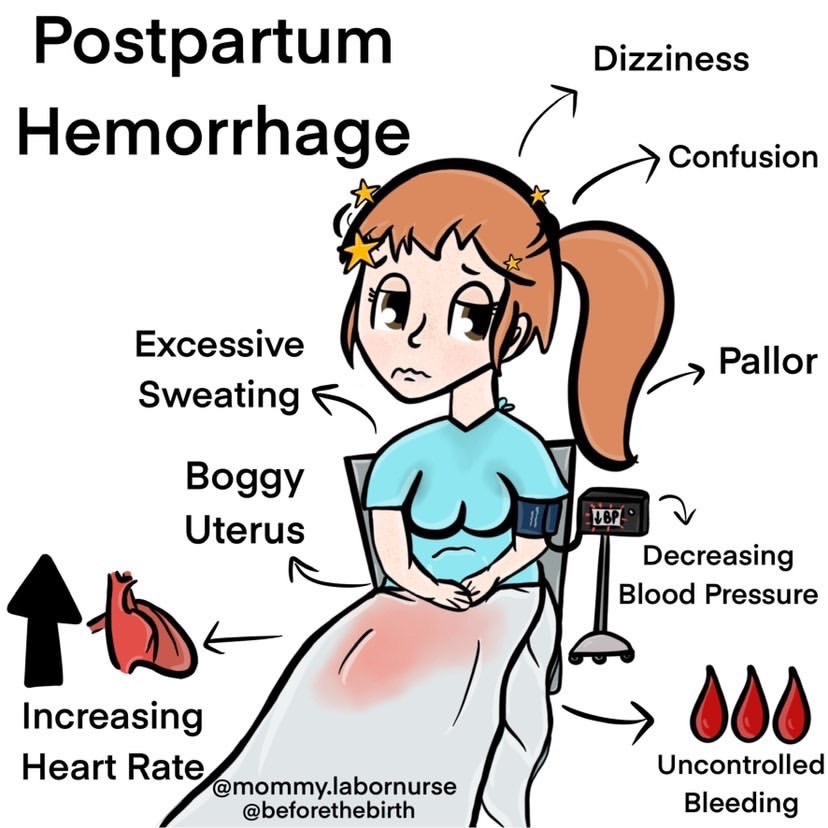 What Is A Boggy Uterus, Definition, Signs And Symptoms,, 57% OFF