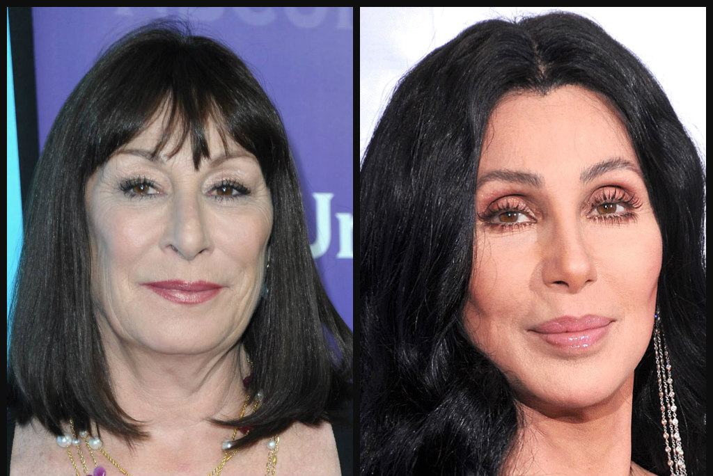 Anjelica Huston Plastic Surgery